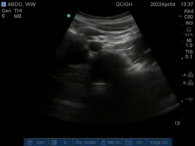 Scans – UBC Ultrasound Club